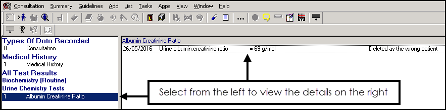 Viewing Deleted Records