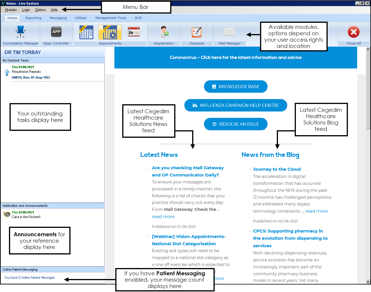 Vision 3 Front Screen