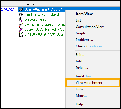 ASSIGN CVD Risk Calculator